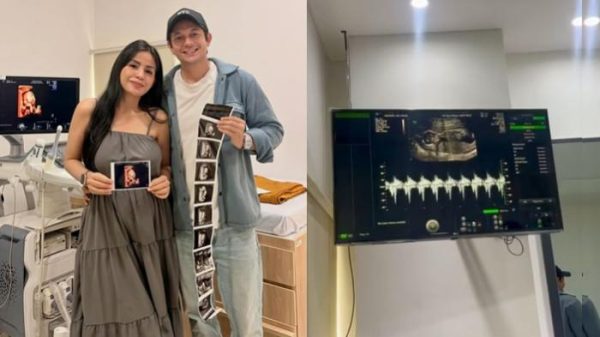 Ingin Kenal Istri Baru Andrew Andika? Tengku Dewi Akui Kirim DM ke ...